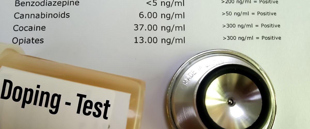 Return To Work Drug Testing | Drug Testing After The Festive Period
